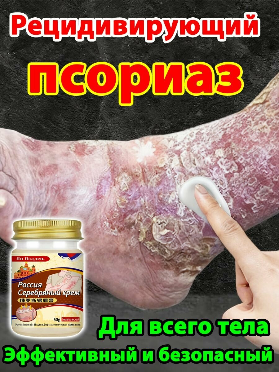 Мазь от псориаза китайская Антипсориаз крем негормональный от дерматита и экземы снимает зуд покраснение и раздражение 50 г