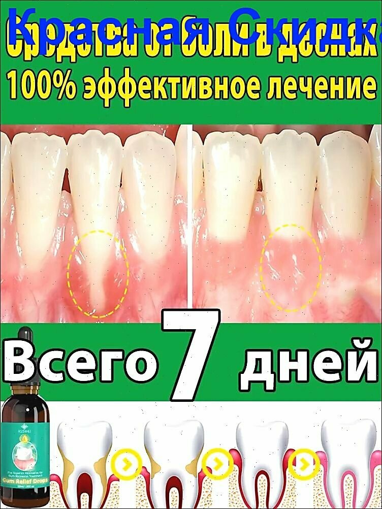 Используется для лечения пародонтита, стоматита, снятия чувствительности и отека десен, восстановления, профилактики и укрепления поврежденных десен, Гигиена полости рта, 30 мл, 1 флакон