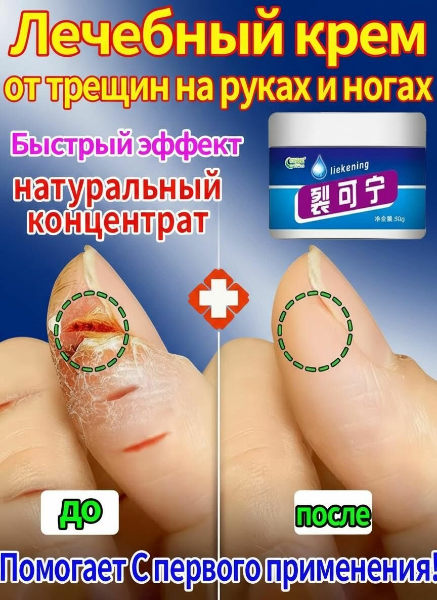 Мазь от трещин на руках и пальцах