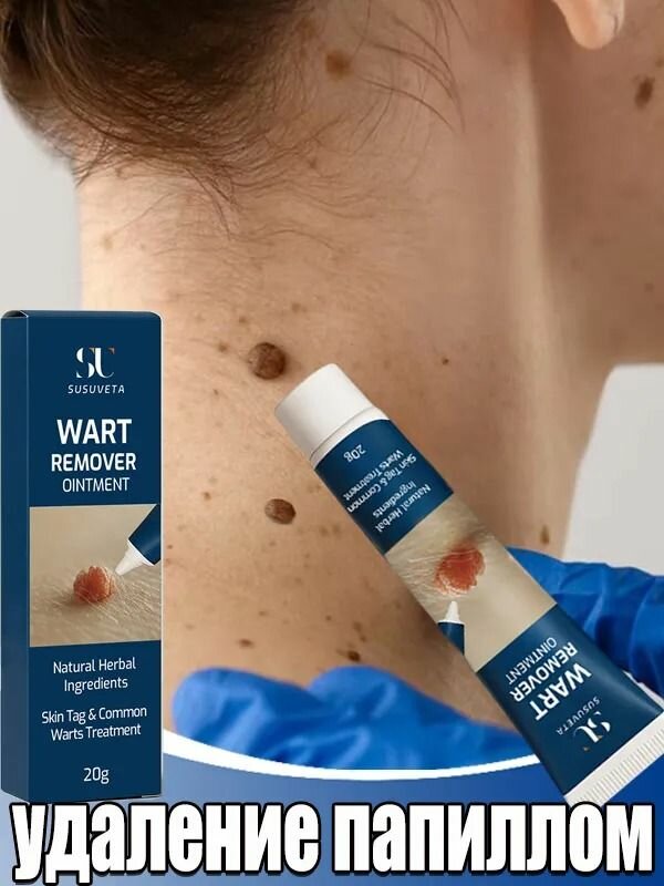 SUSUVETA / Мазь от бородавок, Крем средство для удаления бородавок, папиллом и родинок, безболезненно, не оставляет следов без побочных эффектов / 20г