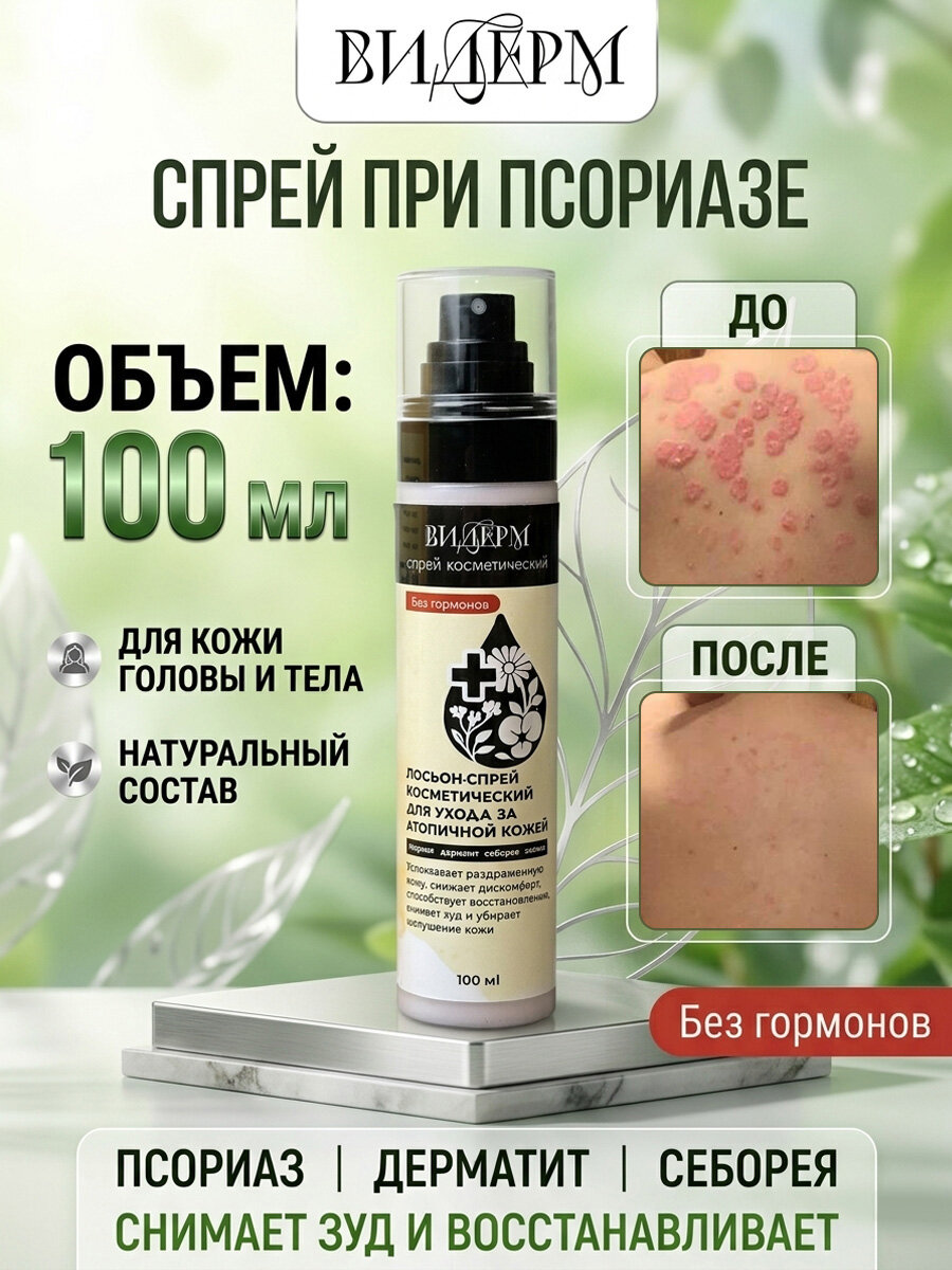 Спрей косметический от псориаза, дерматита, экземы 100 мл