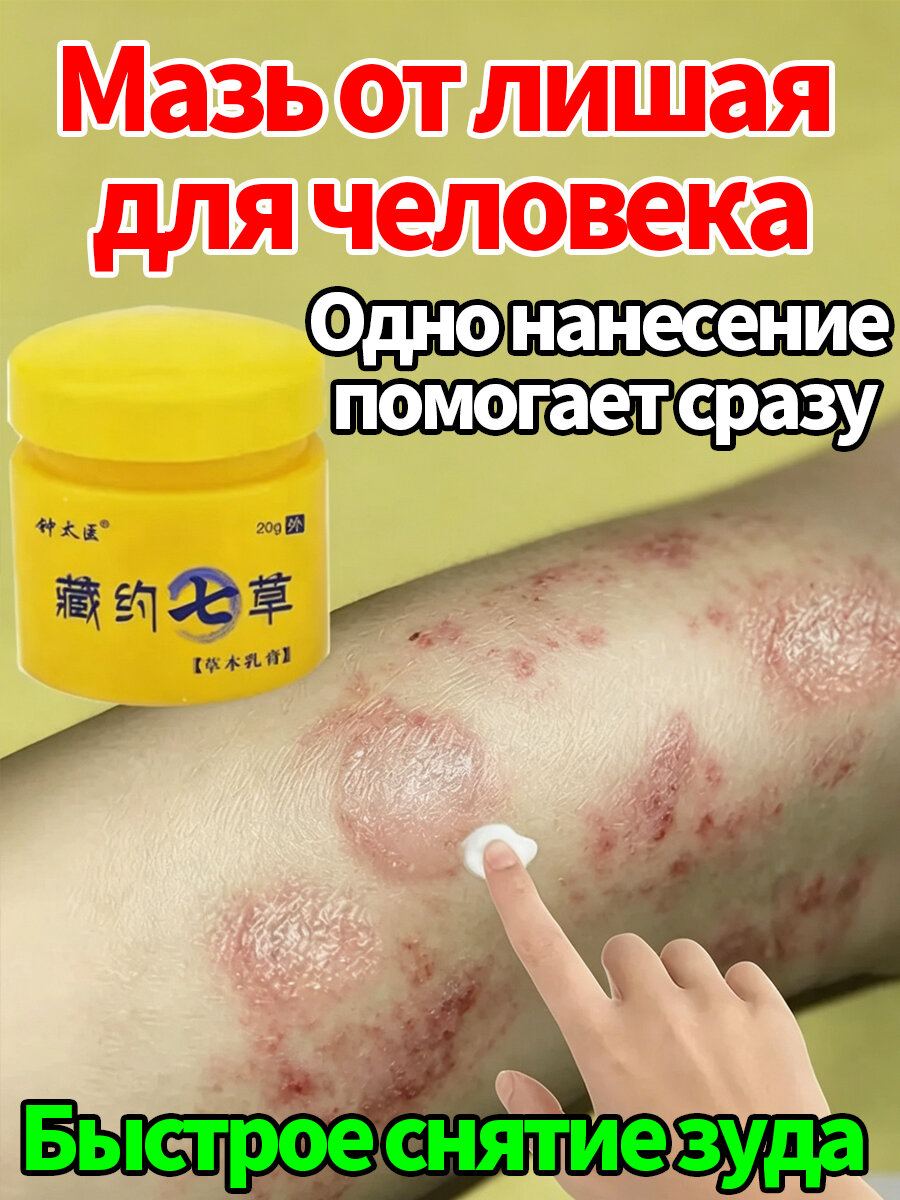 Крем мазь от псориаза, экземы, дерматита, лишая, прыщей, акне, 20г / Мазь от псориаза / Крем антибактериальный для кожи
