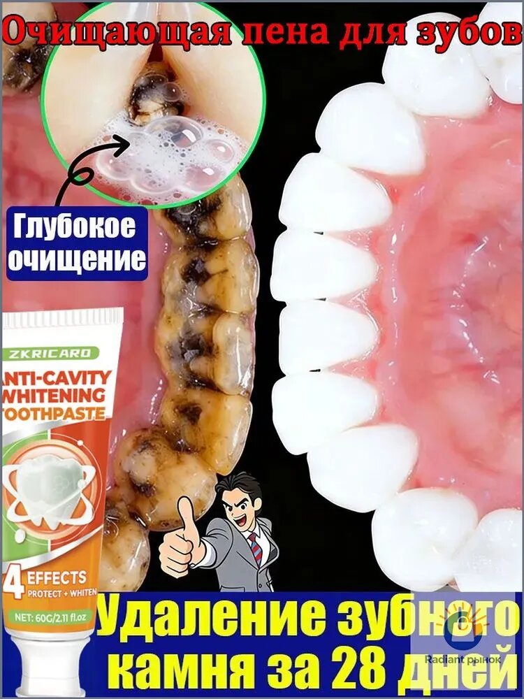 Зубная паста от кариеса и отбеливания, свежее дыхание, с фтором, мята, удаление налета, для всей семьи, убная паста от кариеса и отбеливания, для взрослых и детей.
