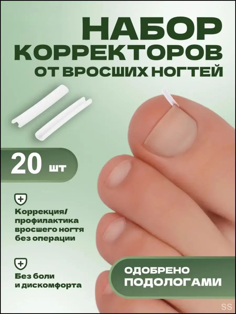 Корректор От Вросших Ногтей На Ногах