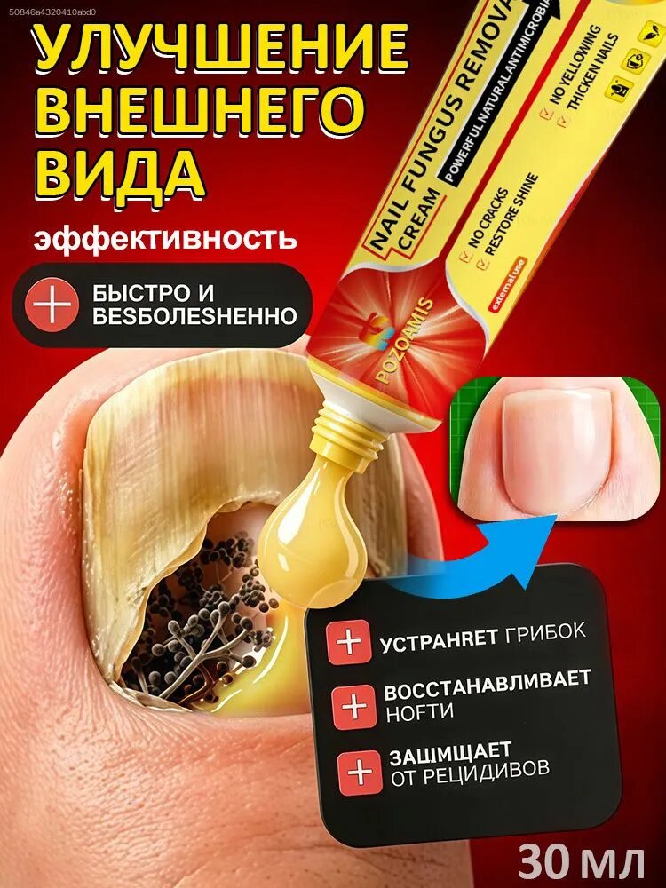 Крем от грибка ногтей лечение онихомикоза, восстановление ногтя, укрепление. Без гормонов. 30 г