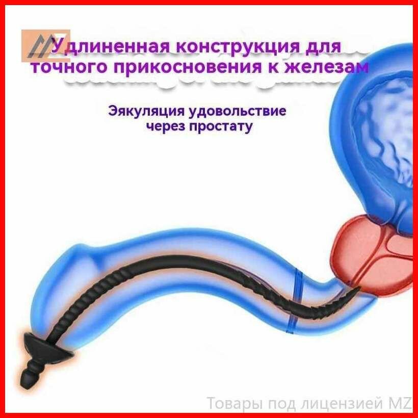 Уретральное расширение