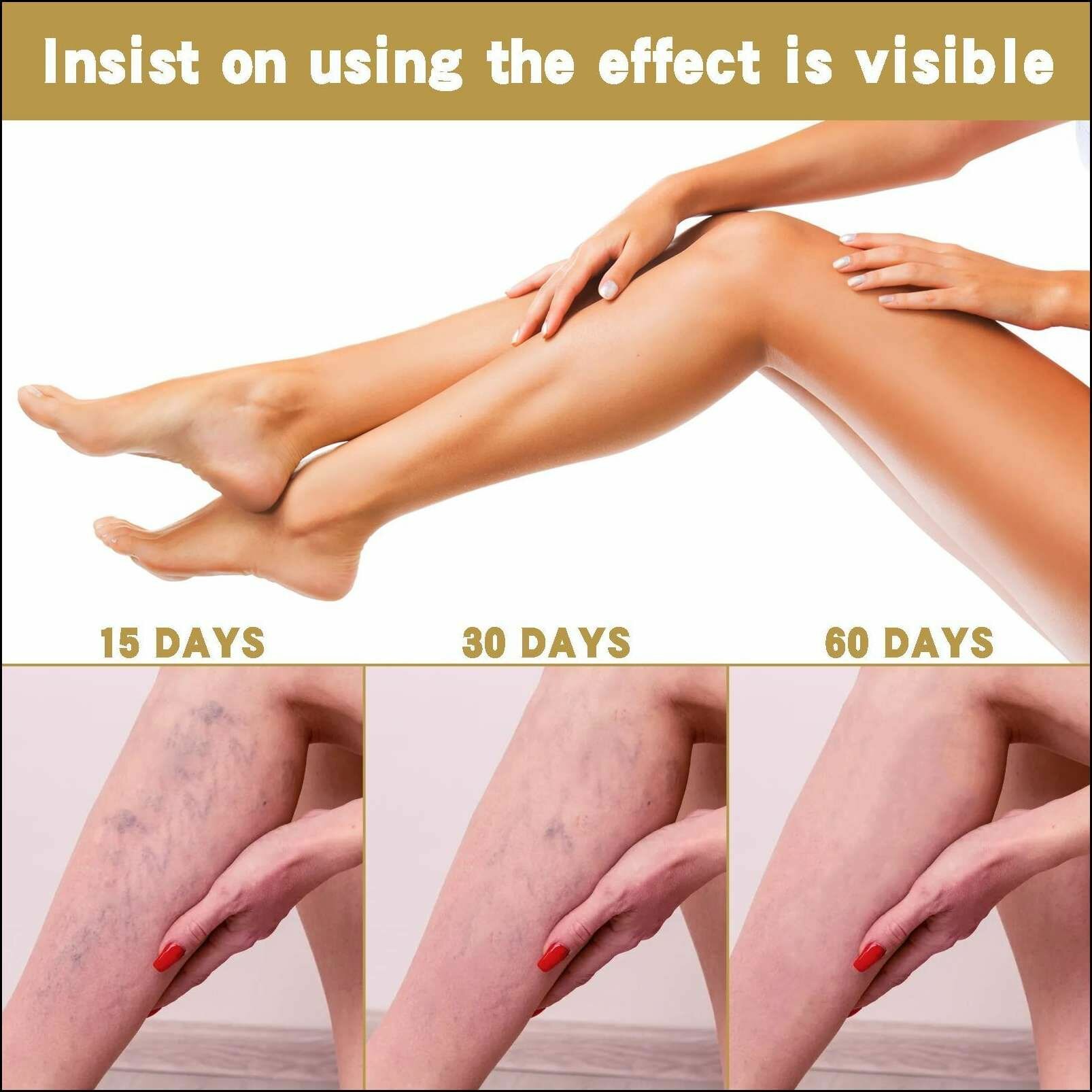 Ouhoe крем от варикоза вен 30г