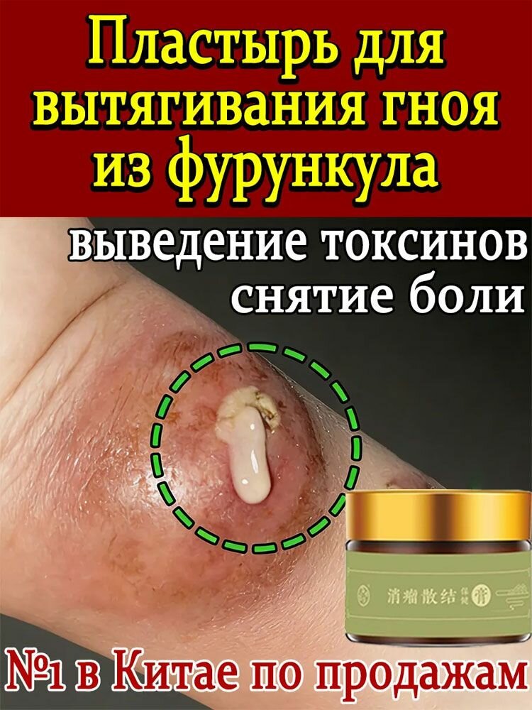 Китайская мазьВытягивающий от фурункулов, акне и гнойниковснимает воспаление и покраснение при акне и чириях