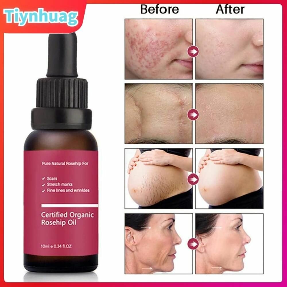 Масло шиповника, холодного отжима, для мягкости и молодости кожи