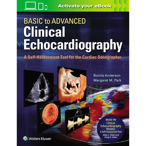 Basic to Advanced Clinical Echocardiography: A Self-Assessment Tool for the Cardiac Sonographer，Reprinted paperback book