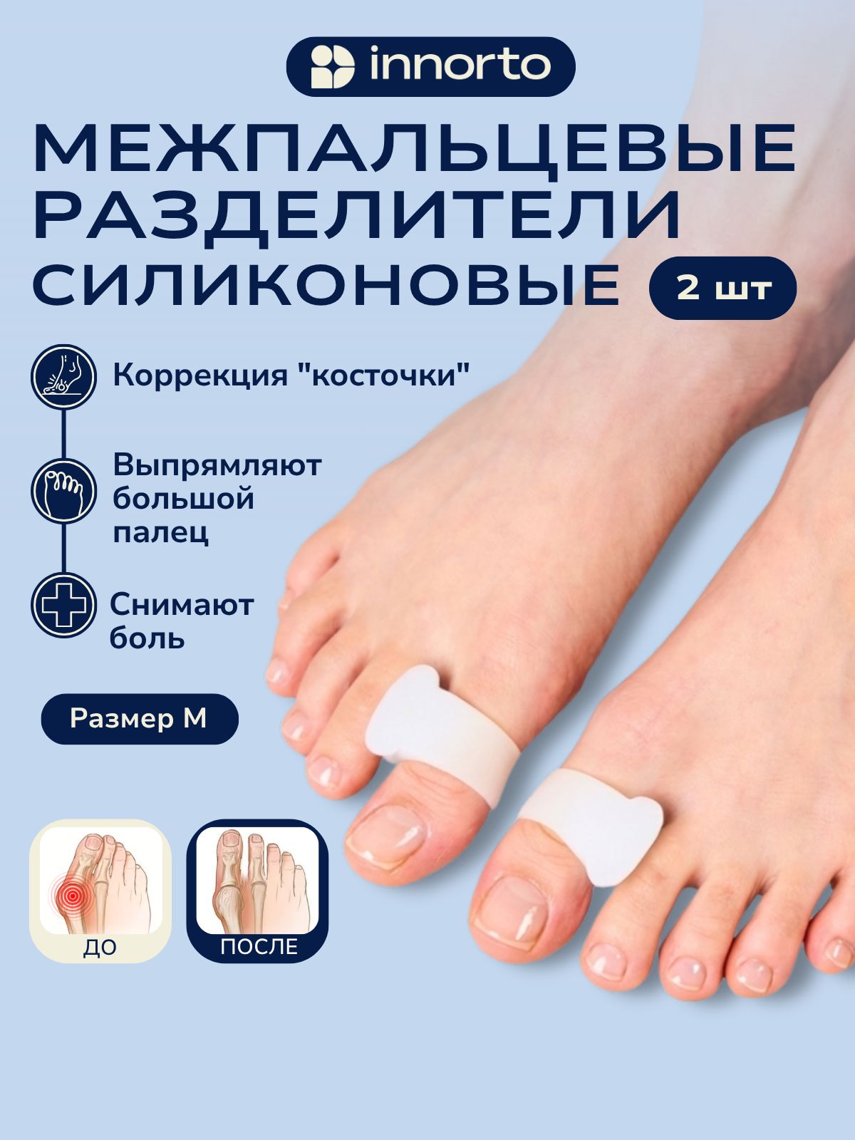Корректоры для большого пальца с силиконовым кольцом, Разделители для пальцев ног ортопедические, INNORTO