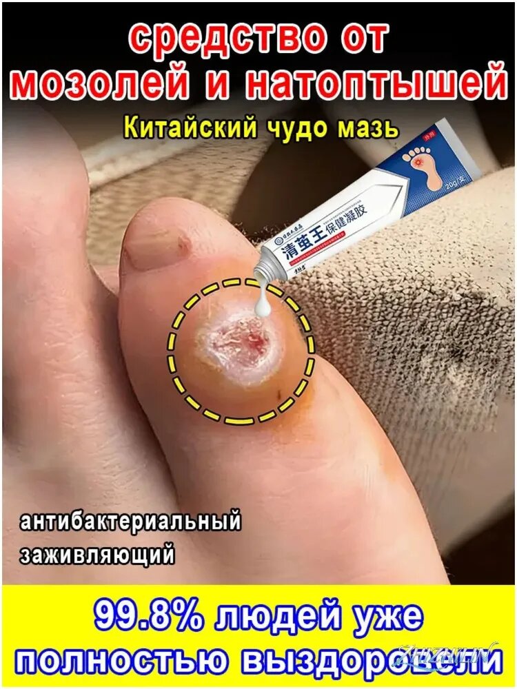 Пластырь от мозолей, стержневых натоптышей и бородавок 20 г Китайский чудо мазь