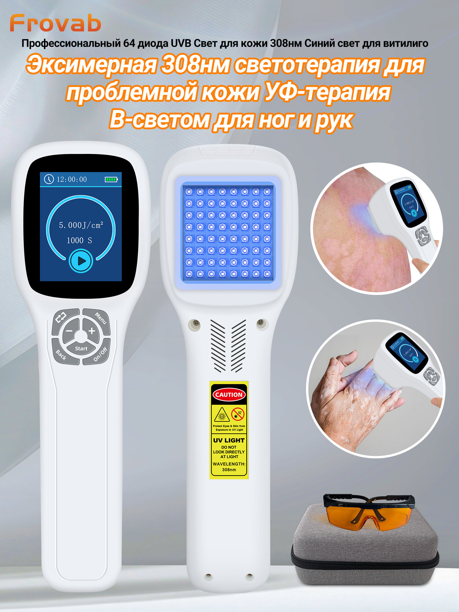 Портативный УФ облучатель Frovab 308нм 49 диода, использование дома, терапия кожных болезней взрослых разных стадий
