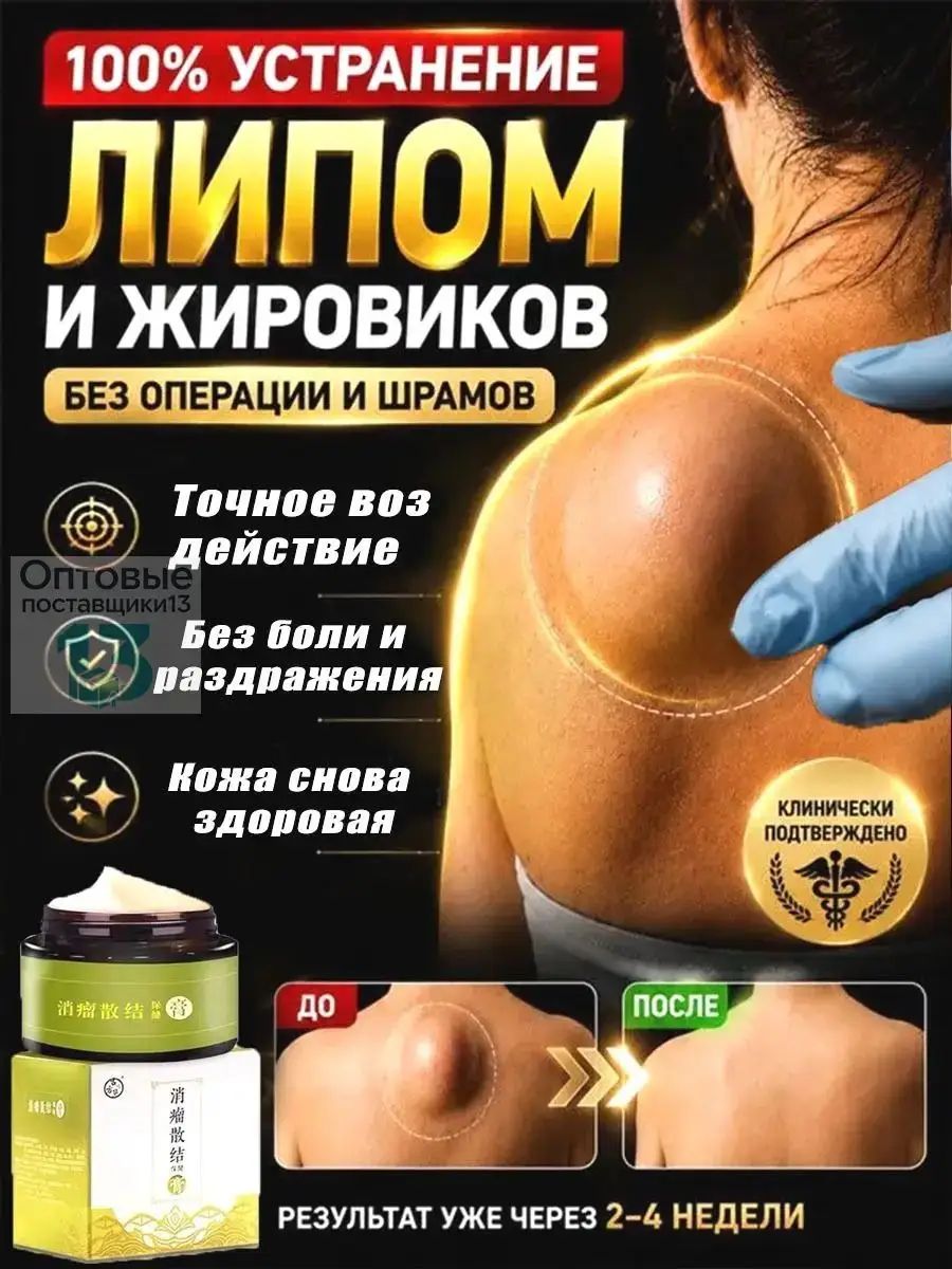Мазь убирает шишки и уплотнения
