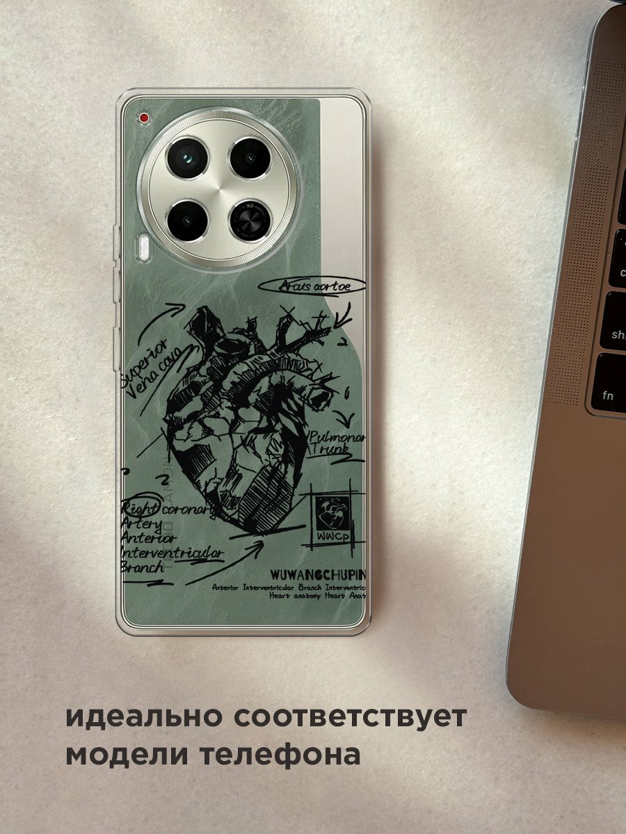 Чехол на Tecno Camon 30 5G / Текно Камон 30 5G с принтом "Анатомическое сердце 2", прозрачный — фото 1