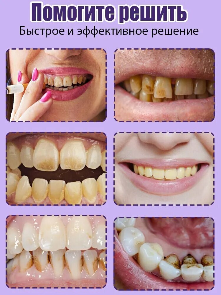 Отбеливающая и противокариесная зубная паста. Эффективно удаляет пятна от курения, кофе и чая, предотвращает кариес и освежает дыхание. 30 мл.