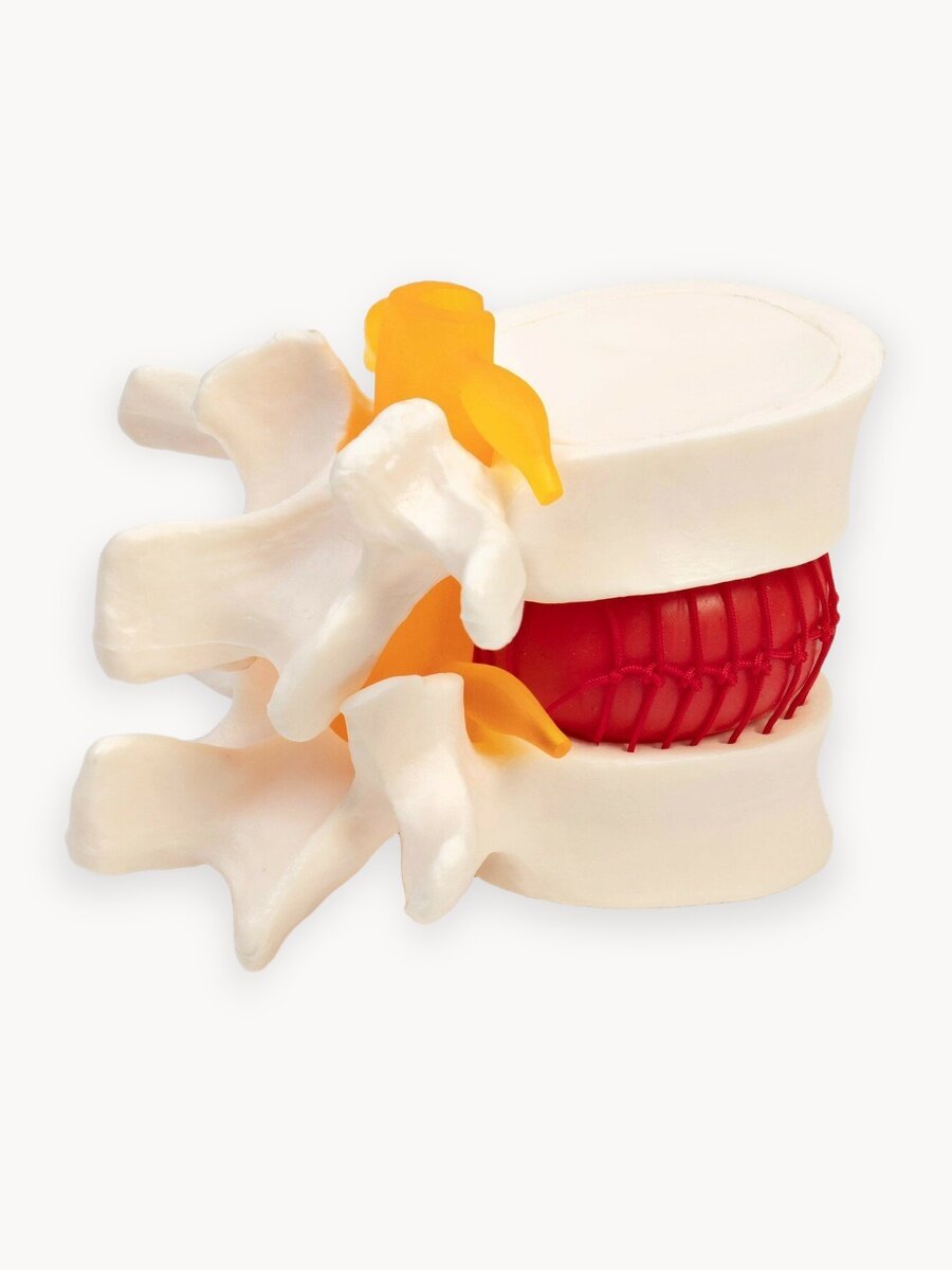 Макет "Межпозвонковый диск" 11*10*8см