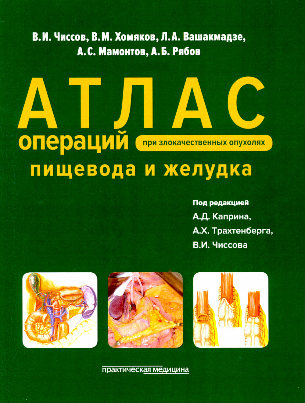Атлас операций при злокачественных опухолях пищевода и желудка (обл.). Чиссов В. И, Хомяков В. М, Вашакмадзе Л. А.