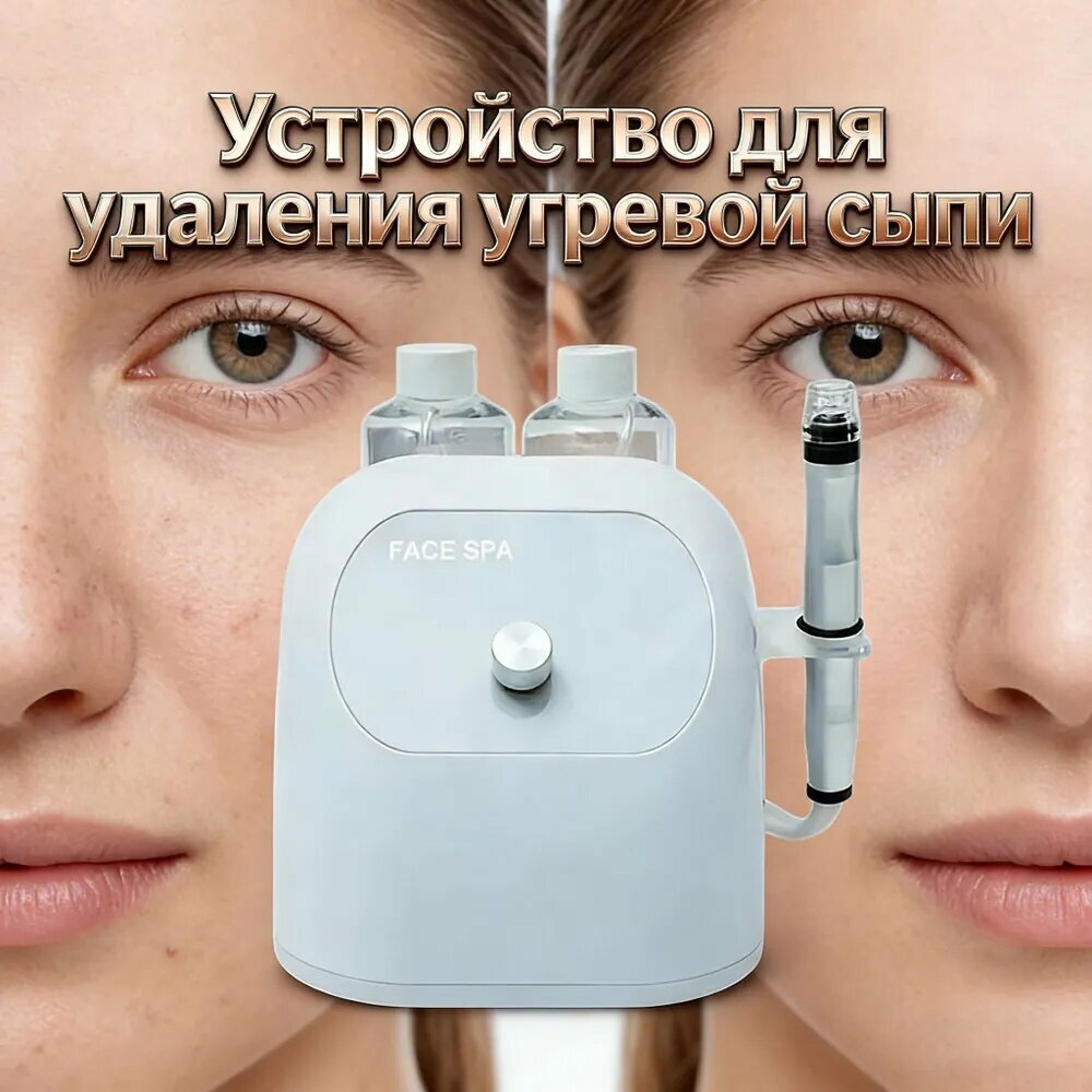 Чистка лица US-4, лифтинга, питания и микротокового массажа кожи, скрабер/Устройство для очистки пор и угрей, а также пузырьковый вакуумный аппарат