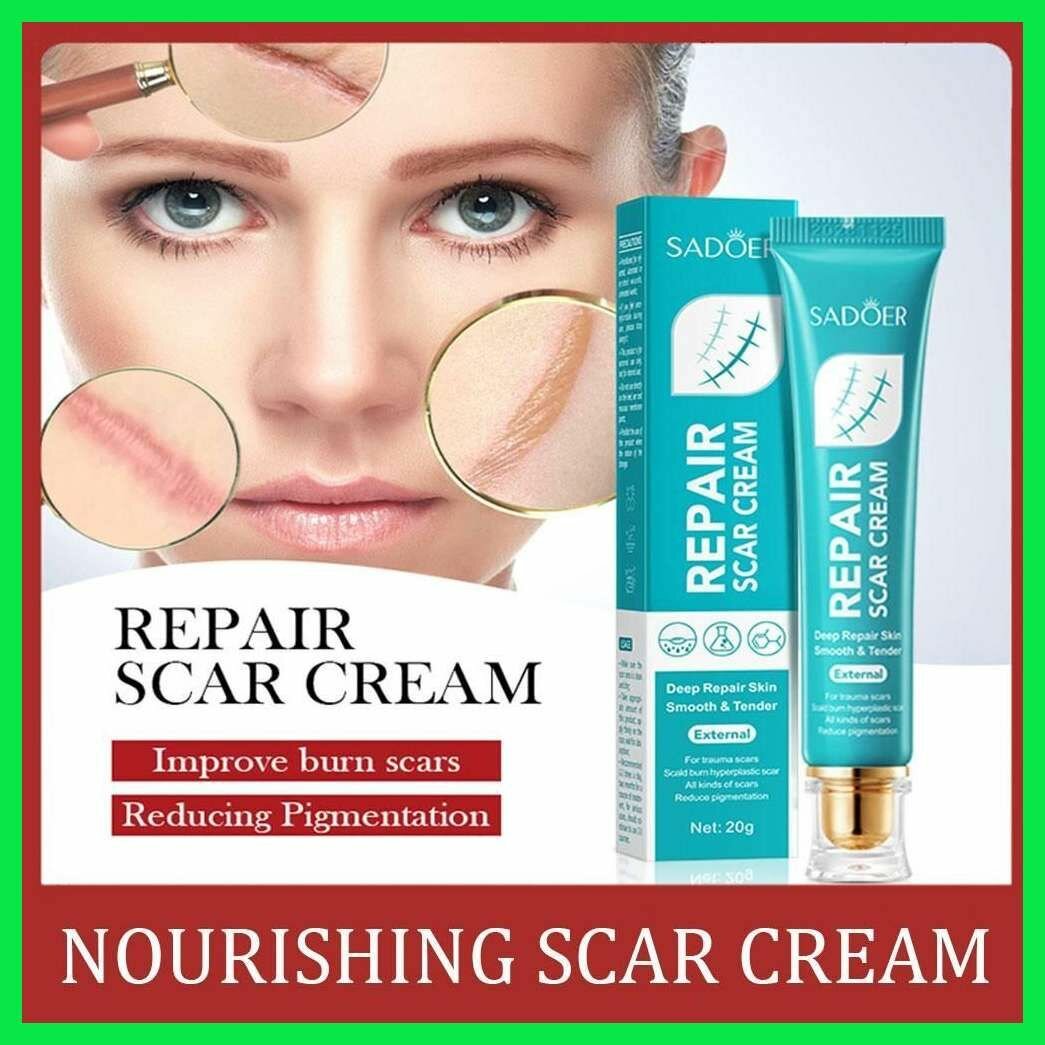 Крем-гель от шрамов, рубцов, растяжек, травм и пигментации, мазь от следов прыщей для лица и тела