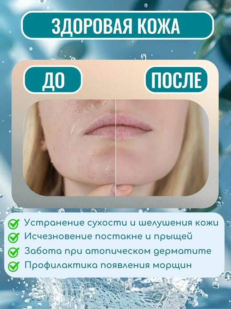 Фильтр для душа — фото 1