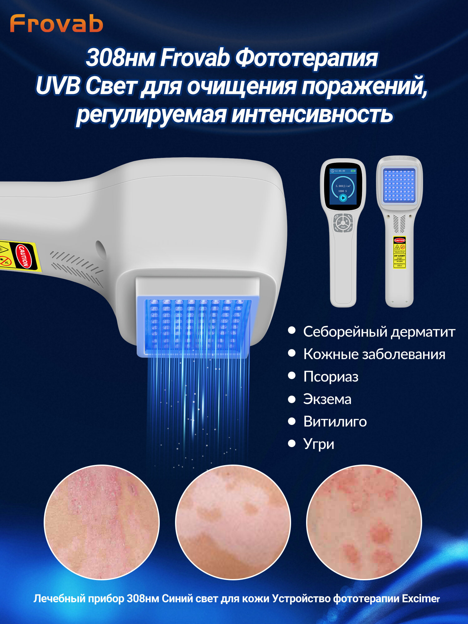 Портативное устройство Frovab 308нм, 64 светодиода, для домашней терапии витилиго, псориаза, экземы и кожных проблем