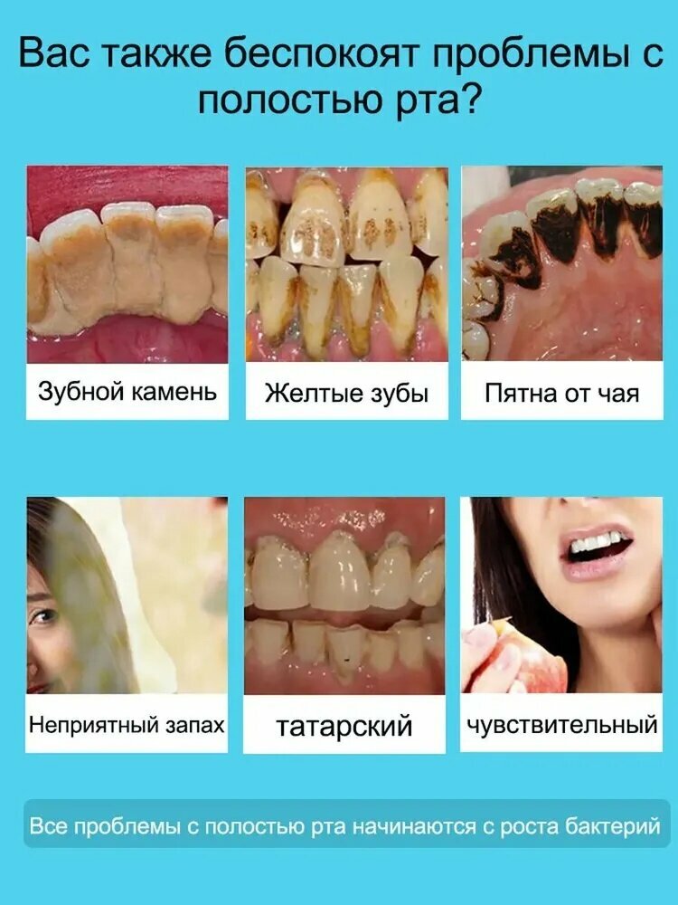 Зубная паста для дырки в зубе, глубокого кариеса и пульпита, Снимает боль, восстанавливает при поражении кариесом у взрослых, Свежее дыхание, 100 г, 1 шт.