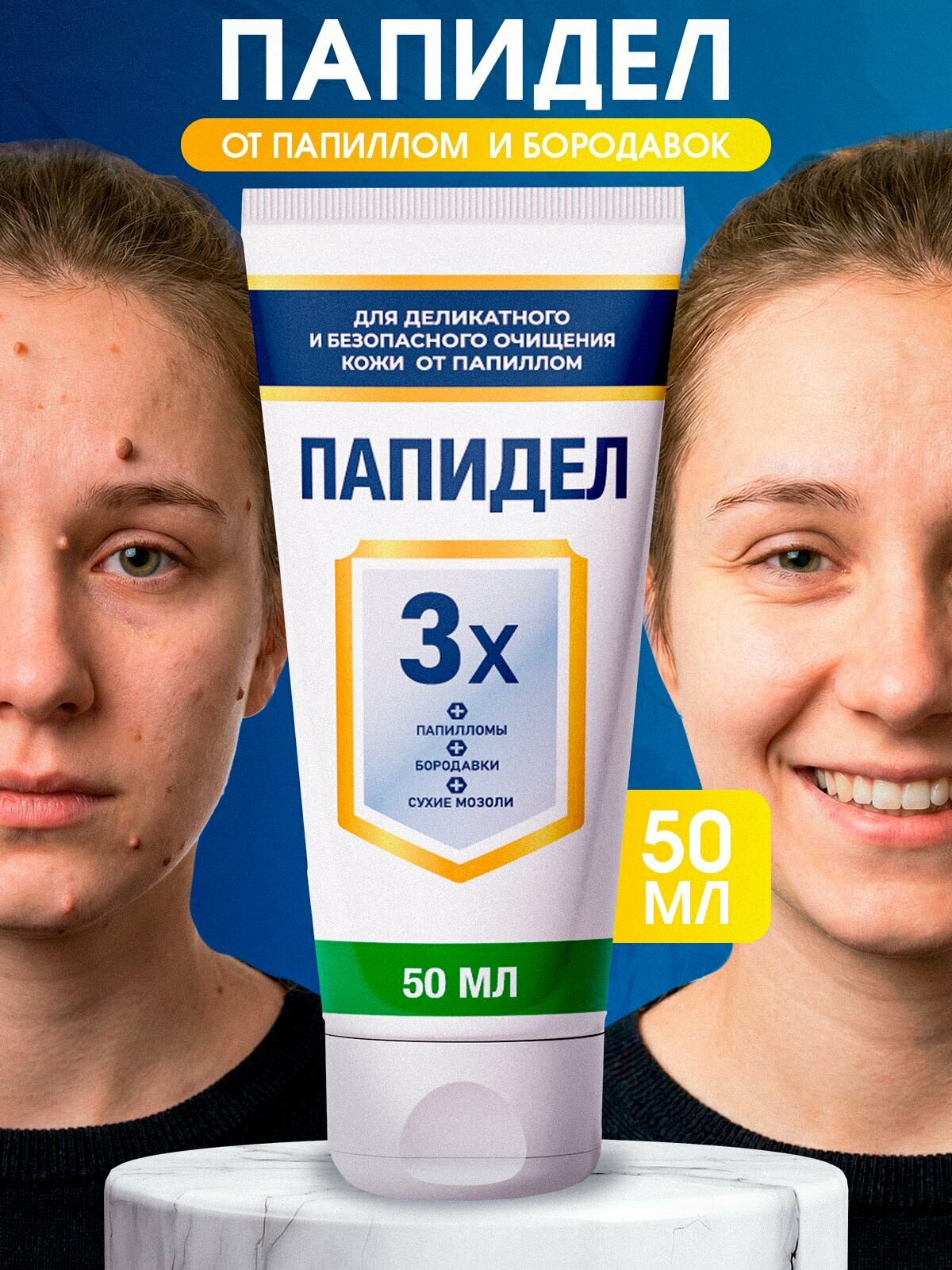 Папидел (Papidel): Средство от папиллом, бородавок и сухих мозолей, крем-гель для удаления новообразований, 50 мл
