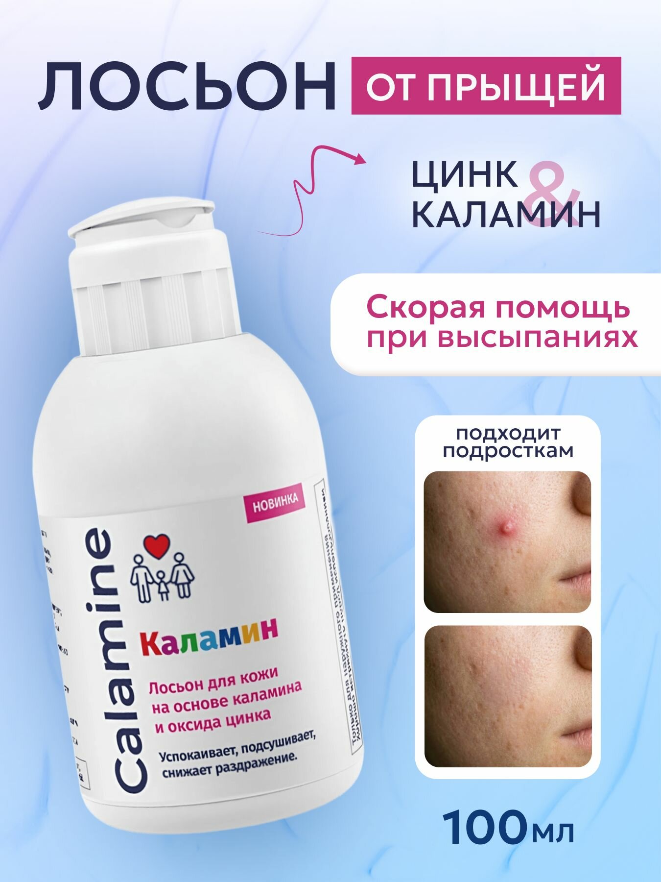 Каламин лосьон для кожи / Лосьон успокаивающий от ветрянки, зуда и раздражения, 100 мл
