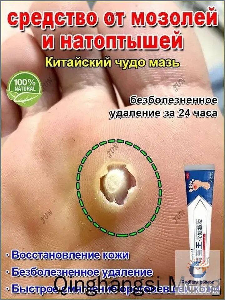 Эксклюзивный лечебный пластырь для безболезненного удаления мозолей, бородавок и натоптышей с быстрым смягчением, 20 г