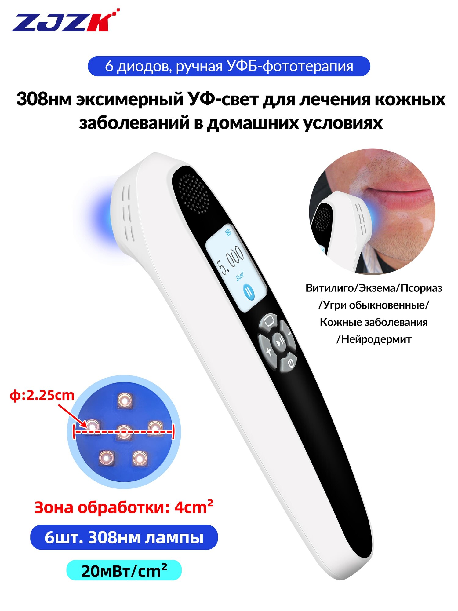 ZJZK иниатюрный эксимерный УФБ-аппарат для светотерапии с длиной волны 308 нм, предназначенный для лечения витилиго