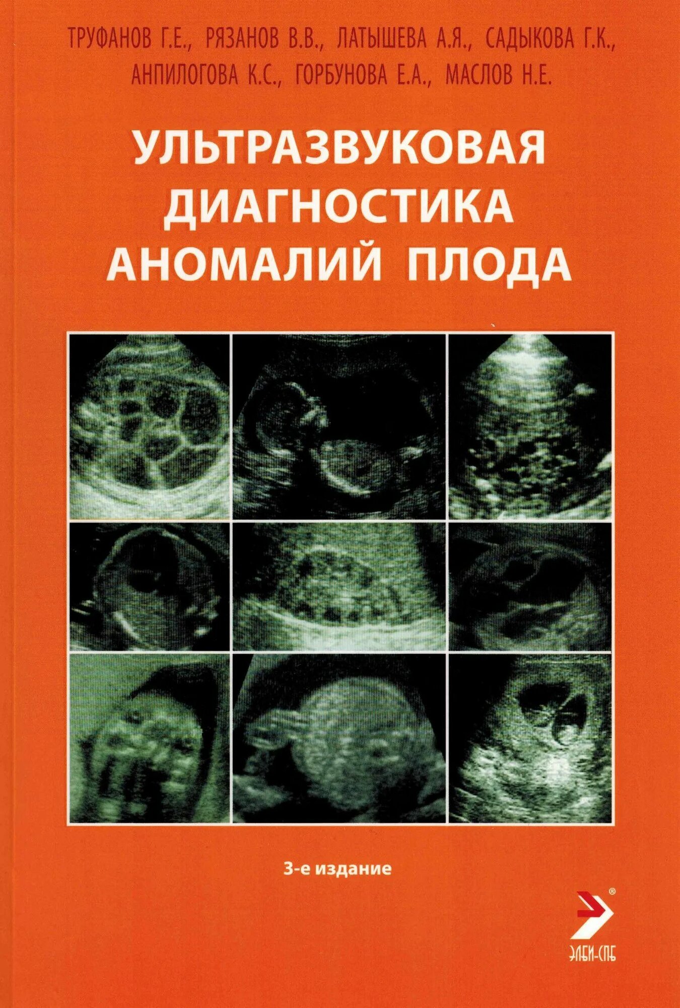 Ультразвуковая диагностика аномалий плода