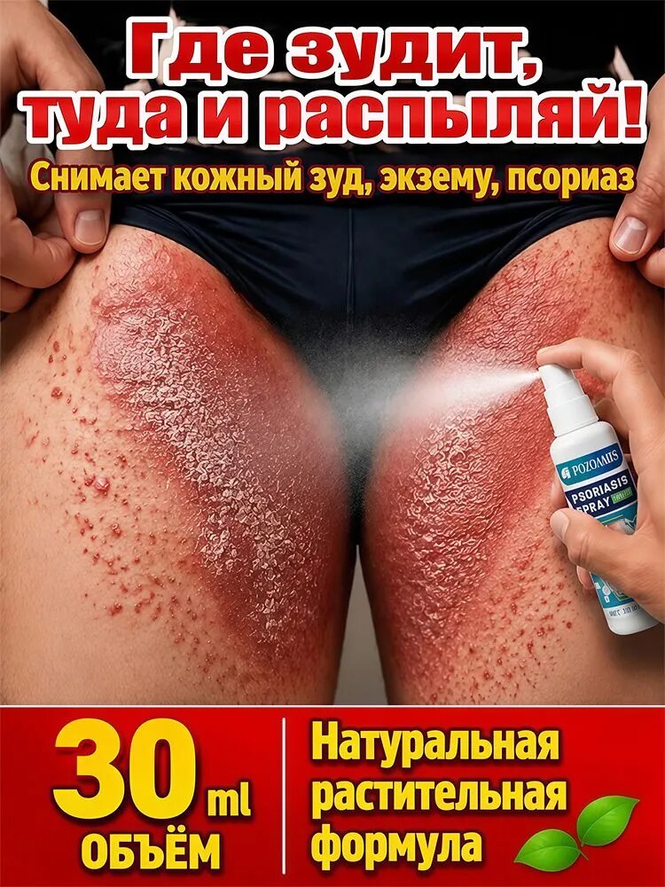 Этот чудодейственный китайский лечебный спрей используется для лечения псориаза, экземы и сухости кожи. Это эффективное средство по уходу за кожей, которое снимает зуд и раздражение.