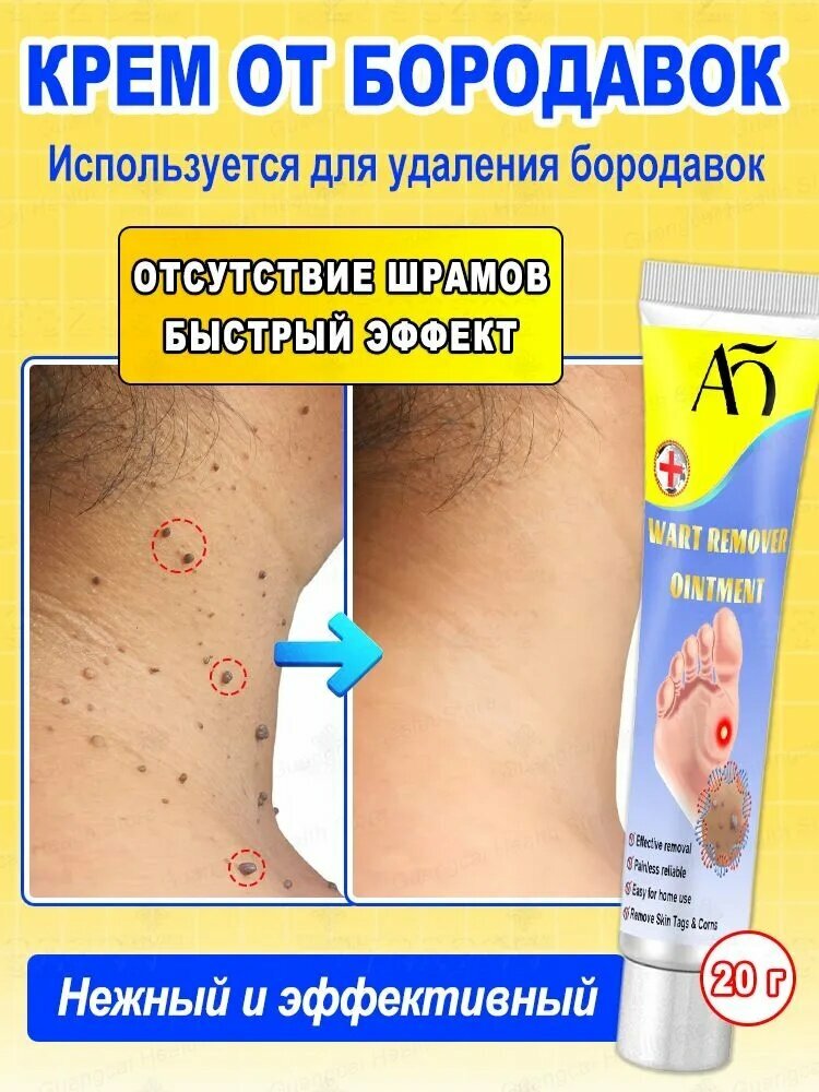 Крем Челидоний используется для лечения папиллом и бородавок и может наноситься на тело, руки и ноги. Он безболезненный, не вызывает раздражения и помогает предотвратить рецидивы. 20 грамм.