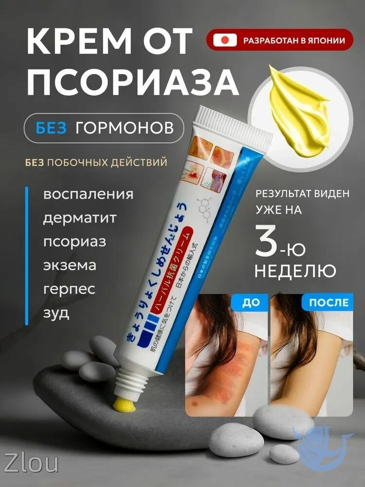 Эксклюзивная косметика для ухода, мазь против экземы и псориаза
