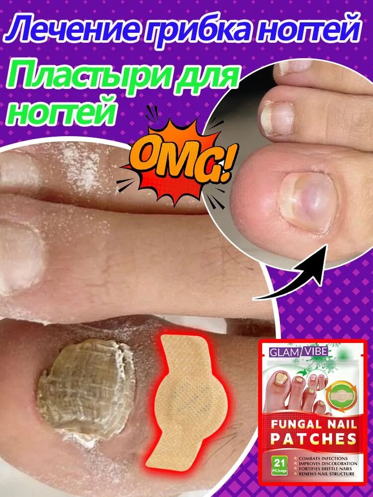 Пластыри для лечения онихомикоза быстро устраняют грибковые инфекции ногтей на руках и ногах, восстанавливают ногти, укрепляют ногти и кутикулу, 21 пластырь.