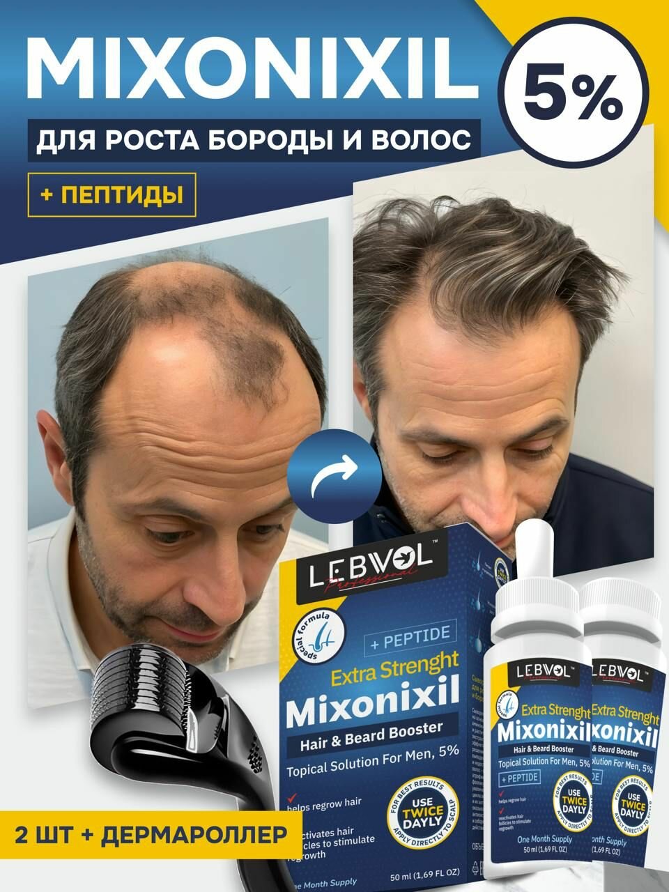 Mixonixil 5% Средство для роста бороды волос и усов / Сыворотка против облысения у мужчин / Лосьон от выпадения волос