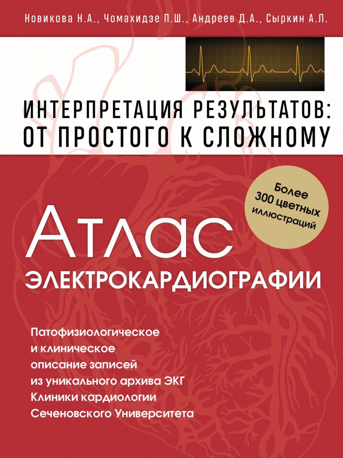 Атлас электрокардиографии. Интерпретация результатов: от простого к сложному [Цифровая книга]