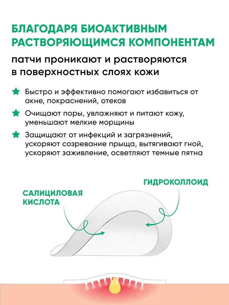 Патчи для лица от прыщей и акне — фото 1
