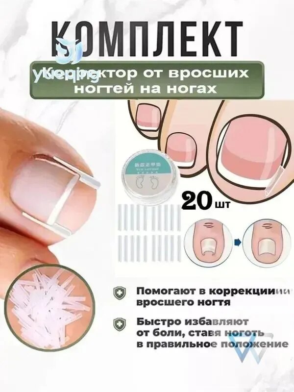 Корректор От Вросших Ногтей На Ногах