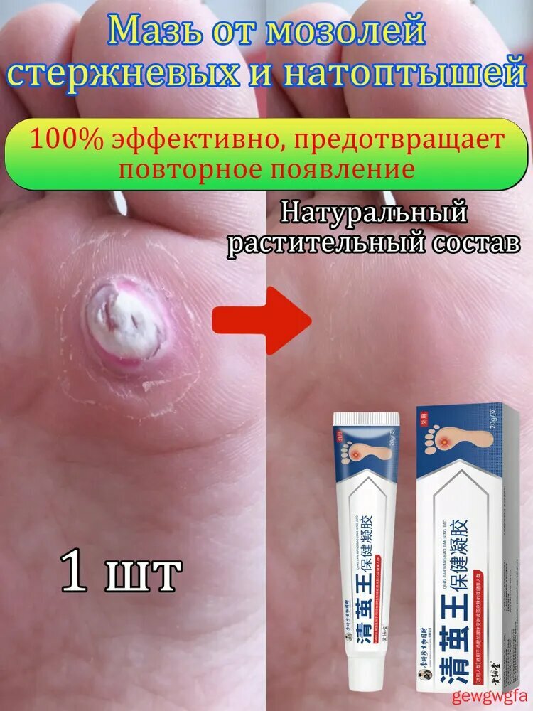 Mазь от мозолей стержневых и натоптышей , Крем от сухих мозолей, шипицы, бородавок, натоптышей,20 г 1 шт.(1)