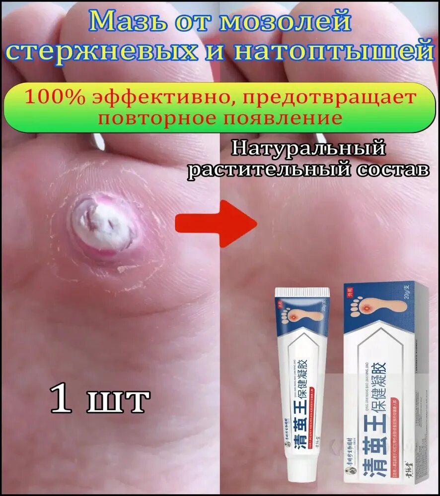 Mазь от мозолей стержневых и натоптышей , Крем от сухих мозолей, шипицы, бородавок, натоптышей,20 г 1 шт.