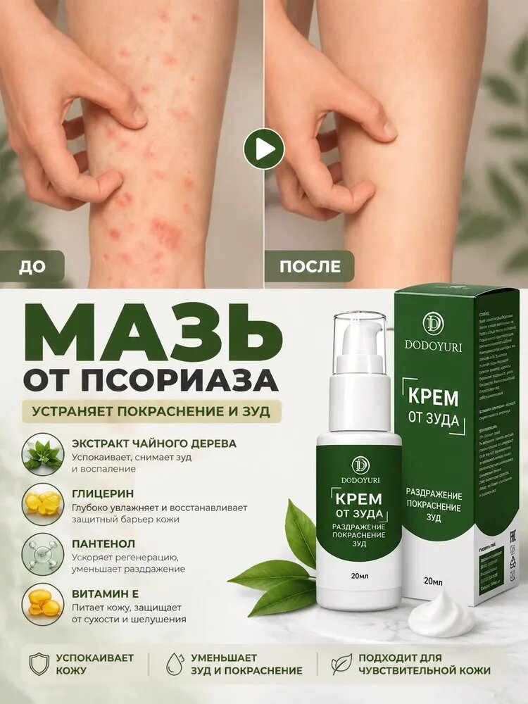 DODOYURI крем от псориаза, при дерматите и раздражении кожи, негормональное успокаивающее средство, 20 мл