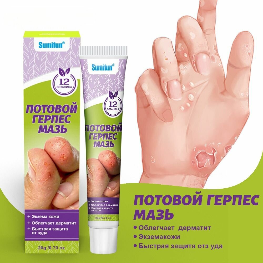 Sumifun Потовой Герпес Мазь, травяной крем для лечения потниц и экземы, 20г