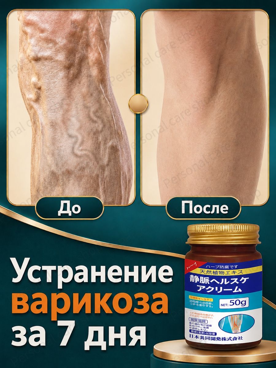 Крем от варикозного расширения вен, 50 г снимает боль улучшает циркуляцию уменьшает расширение вен