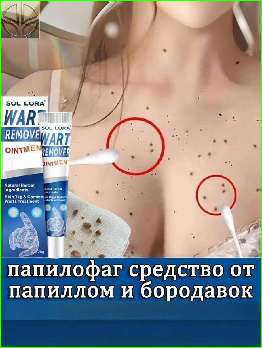 Крем от бородавок SOL LORA на растительных экстрактах, средство для удаления папиллом и подошвенных бородавок, 20 гр