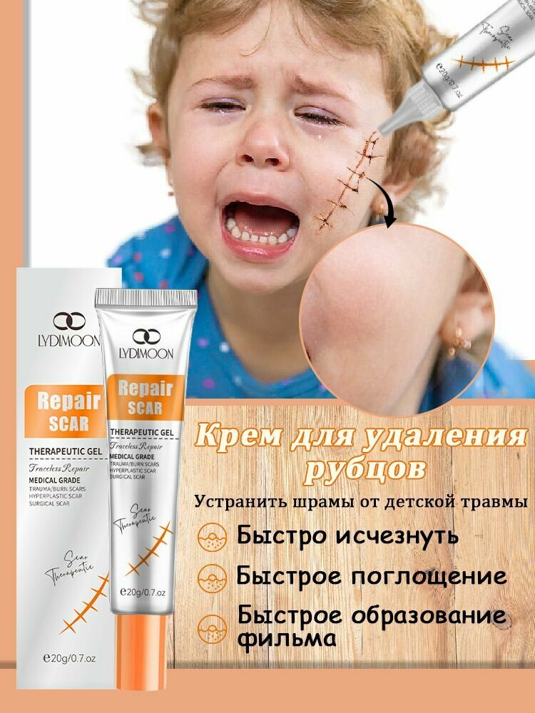 Крем для удаления шрамов, осветляет шрамы