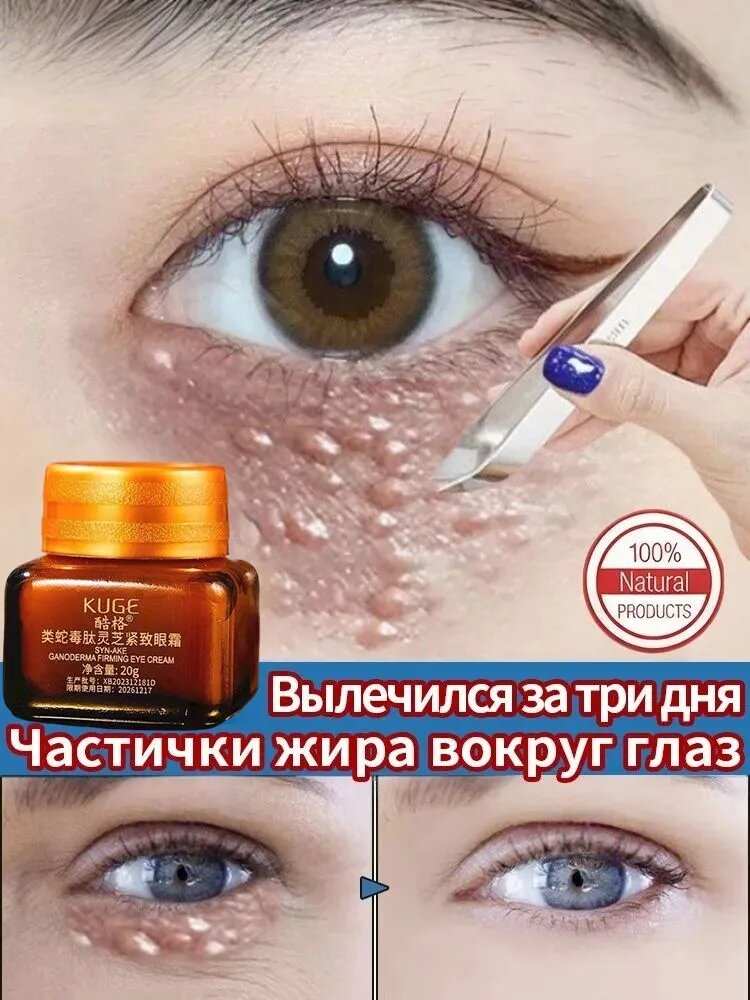 Средство от милиумов на лице, Крем для век антивозрастной, для зоны вокруг глаз, ретидерм крем для век антивозрастной, Чистый натуральный, от темных кругов и морщин, отёков вокруг глаз, 20 г