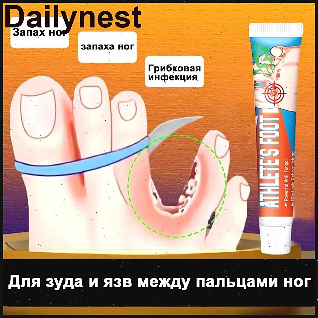 Средство от запаха ног для зуда и язв между пальцами, против грибка, дезодорант эффективное 20г