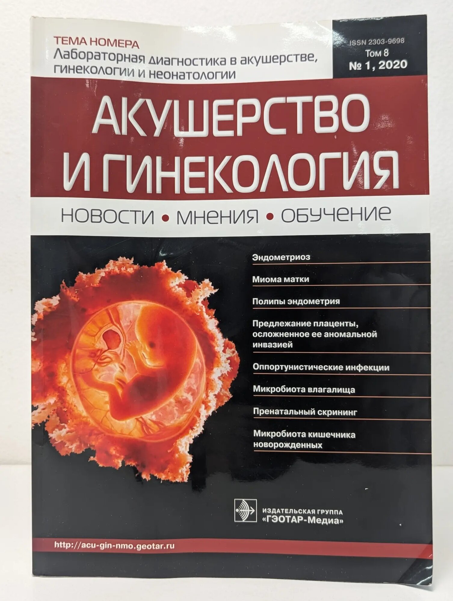 Акушерство и гинекология. Том 8. Выпуск № 1/2020 Сухих Геннадий Тихонович (ред.) 2020